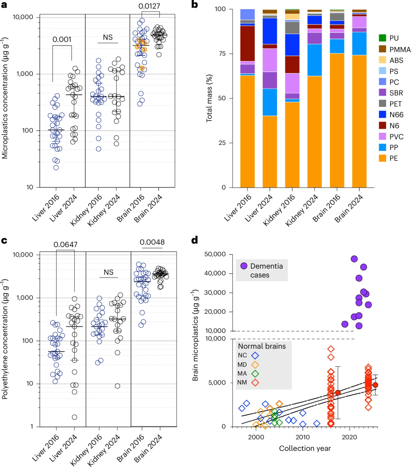 Detecting Microplastics in the Human Brain | Plastics Engineering